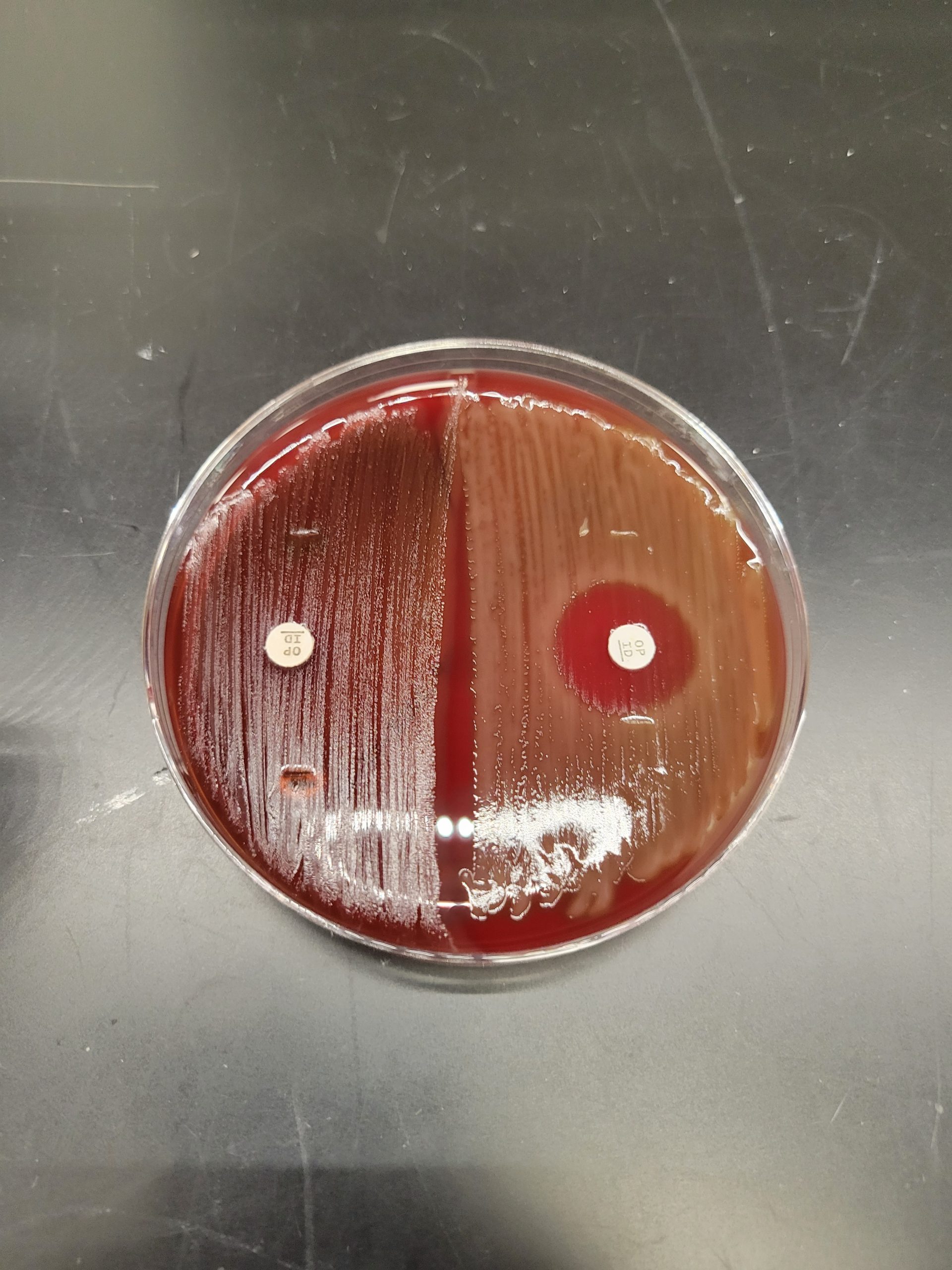 ALPHA AND BETA HEMOLYTIC STREPTOCOCCUS – Laboratory Exercises in ... ALPHA AND BETA HEMOLYTIC STREPTOCOCCUS – Laboratory Exercises in ...